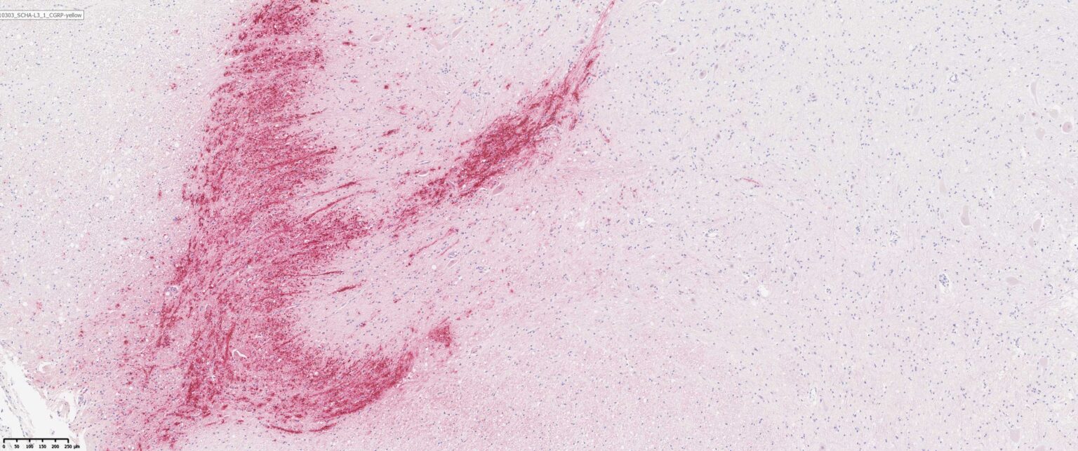 Human Spinal Cord Tissue - AnaBios