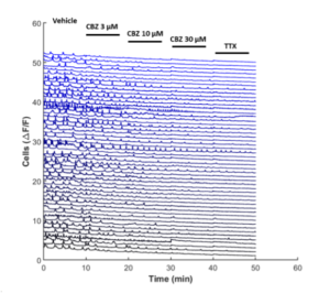 Neurotoxicity Assays Using Human Tissue Samples | AnaBios