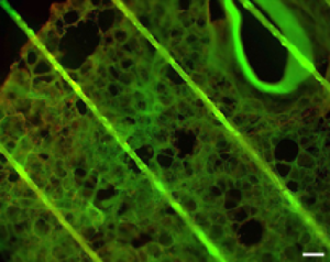 Human Precision-Cut Lung Slices | AnaBios