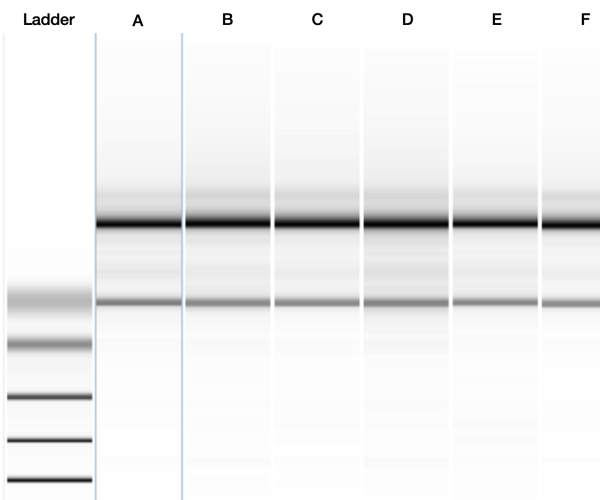 AnaBios Human Lung Tissue - AnaBios